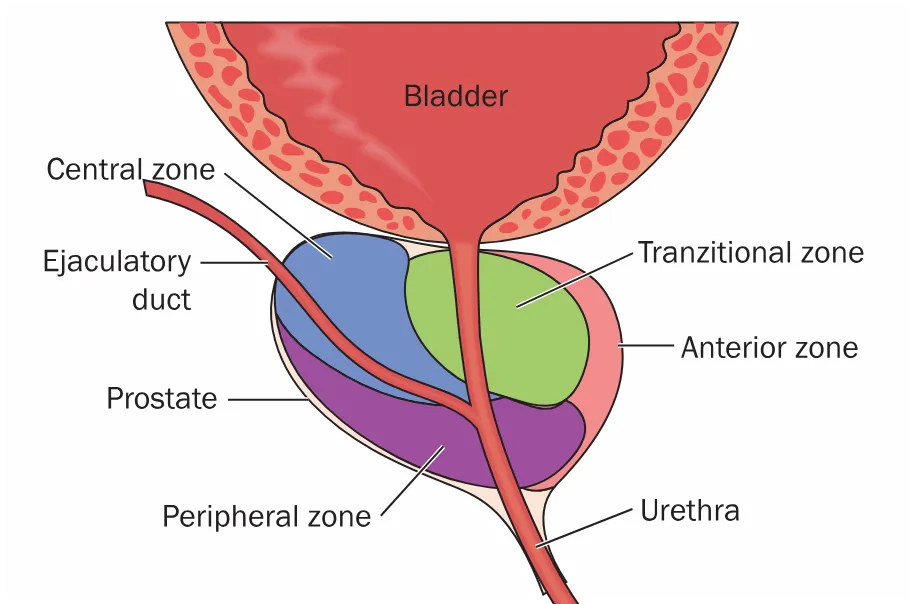 Prostate Zones And Prostate Cancer Prostate Laser Center